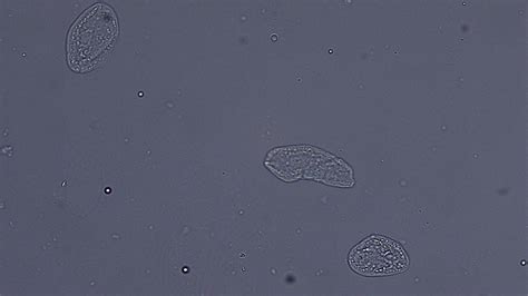 Squamous Epithelial Cell Eclinpath