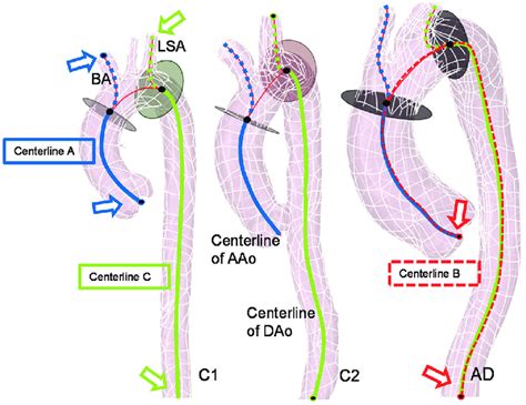 Centrelines Of Different Vascular Branches Detected In The Software Of Vmtk Download