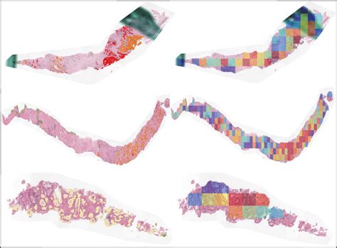 interpretability and visualization left images are segmentation masks