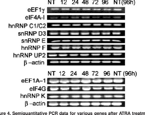 Figure 1 From Comparative Proteomic Analysis Of All Trans Retinoic Acid Treatment Reveals