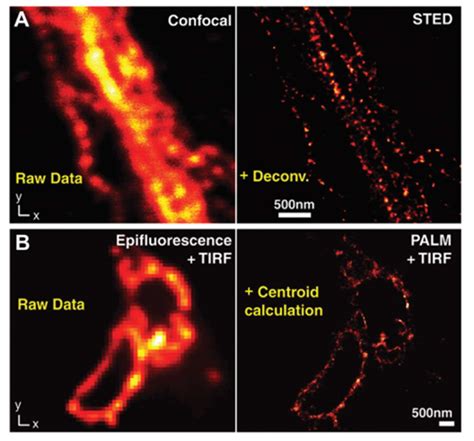 Comparison Between Conventional Fluorescence Microscopy And