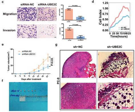 单细胞测序空间转录组描绘从癌前病变到浸润性肺腺癌的动态演变 · Issue 5231 · Ixxmumpduty · Github