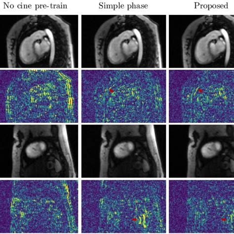 Fpp Image Slices For Different Transfer Learning Methods Download