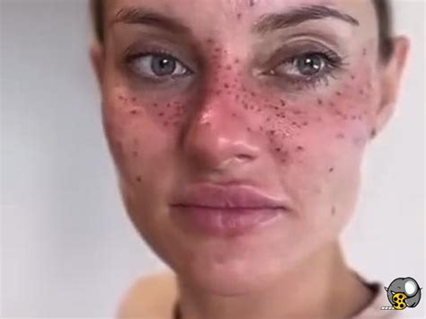 بیماری دیده شدن ، به هر قیمتی تتوی کک ومک هم مد شد فیلو