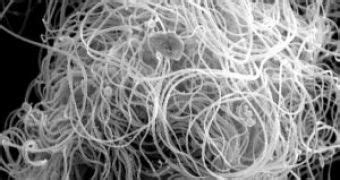 Sperm Proteins Could Reveal The Secrets Of Male Infertility And Of The Origin Of The Sex Softpedia