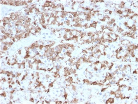 Prolactin Pituitary Tumor Marker Antibody Clone Prl2910 Gene Id 5617