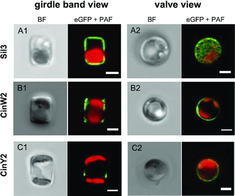 In Vivo Localization Of The Egfp Fusion Constructs Encoding For The Download Scientific Diagram