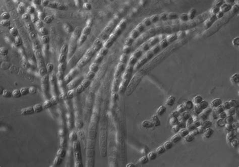 This Figure Shows The Spores Of Podostroma Cornu Damae ×100 Download Scientific Diagram