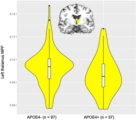 Violin Plots With Overlaid Box Plots Of The Difference In The