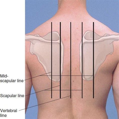 Scapular Line