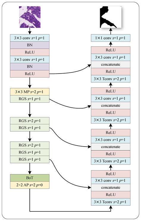 Rgsb Unet Hybrid Deep Learning Framework For Tumour Segmentation In Digital Pathology Images