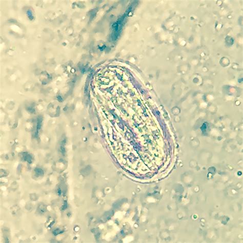 Slides Prepared Specimens Cestode Nematode And Trematode Slides Vet Supplies