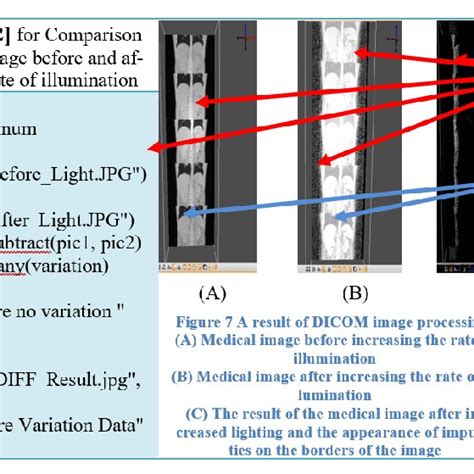 Diagram Schema Of A Basic Architecture Cnn Consists Of Two Parts Download Scientific Diagram