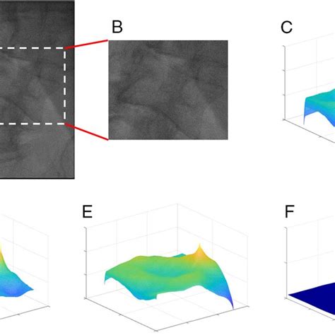 optimization using the similarity matrix a a fixed image—a