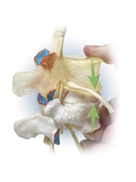 Restricting Lumbar Spine Flexion During Lifting More Efficient