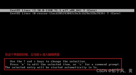 Linux（版本：高于centos76）找回root密码 超级详细！！！oraclelinux的root密码忘记 Csdn博客
