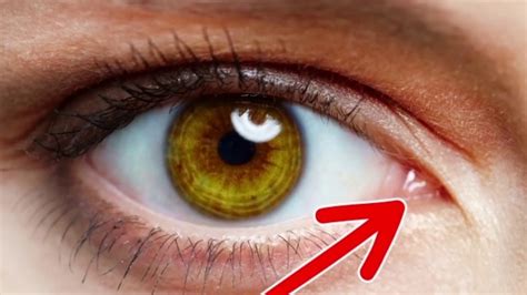 ადამიანის სხეულის 10 ნაწილი რომელიც მომავალში გაქრება Youtube