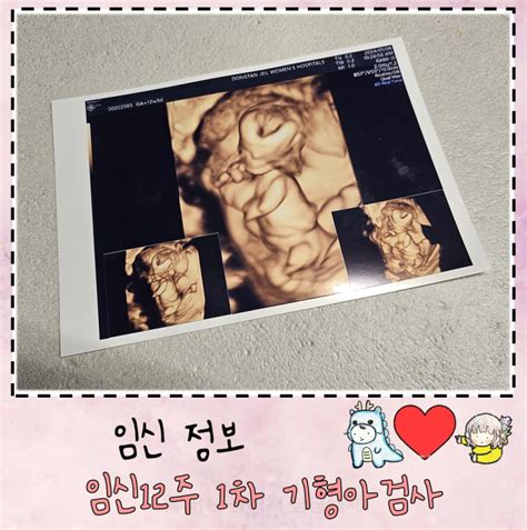 임신 12주 1차기형아검사 정밀 초음파했어요 네이버 블로그