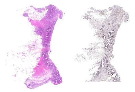 Disentangled Autoencoder For Cross Stain Feature Extraction In