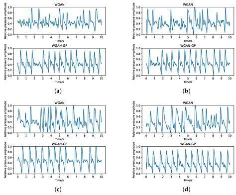 Sensors Free Full Text Towards Generating Realistic Wrist Pulse