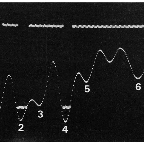 oscillographic trace showing an amplified neural waveform characterized