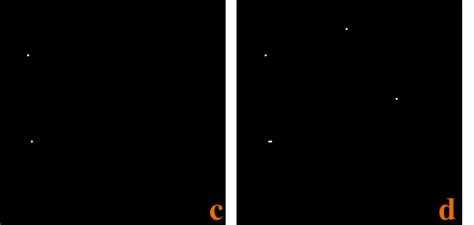 Results Obtained With The Algorithm For Automatic Microcalcification