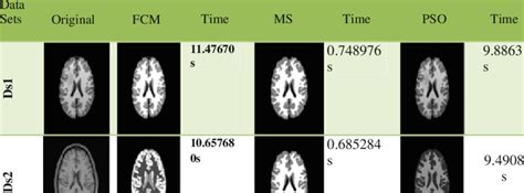 the comparison between fcm mean shift pso segmentation algorithms