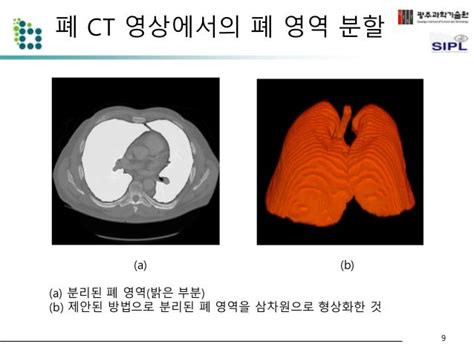 폐 Ct영상에서 Voxel Classification을 이용한 폐 결절 검출