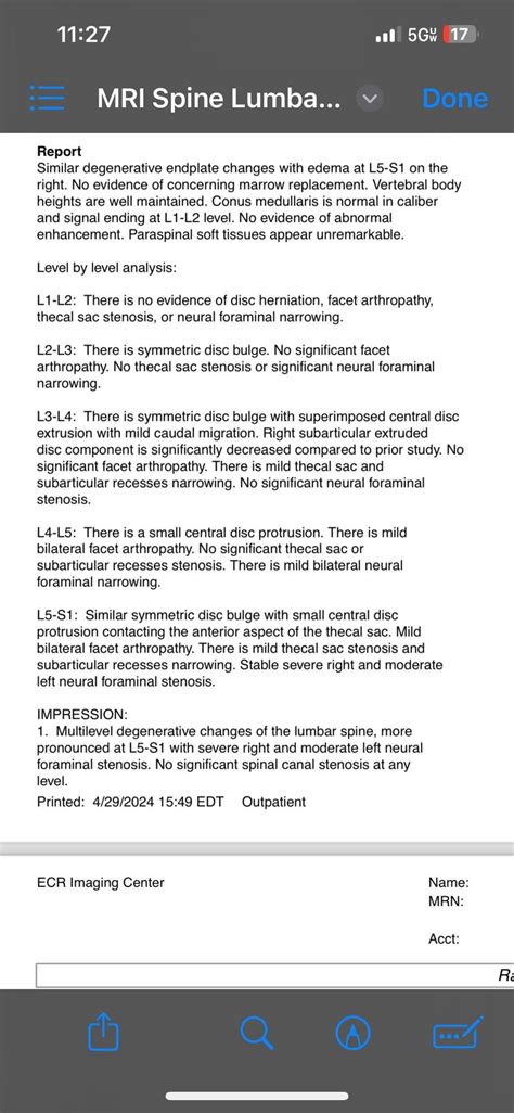 Mri Reportseeking Advice Rsciatica