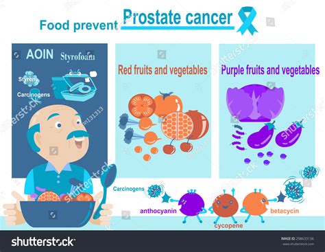 Prevent Prostate Cancer Info Graphic Vector Stock Vector Royalty Free 298633136 Shutterstock