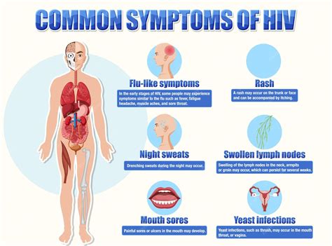 Premium Vector Informative Poster Of Common Symptoms Of Hiv