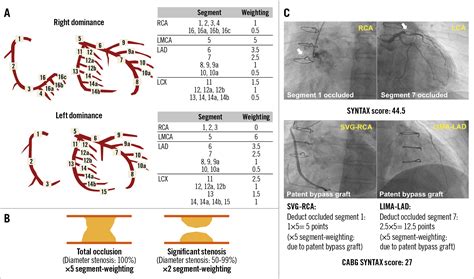 Impact Of The Cabg Syntax Score On All Cause Death At 10 Years A