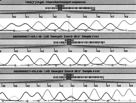 53 Sequencing Analysis Top Picture A Normal Sequence Of Exon 8 Download Scientific Diagram