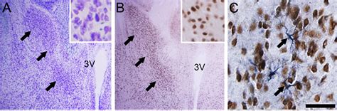 Figure 1 From Sex Differences In Neun And Androgen Receptorpositive