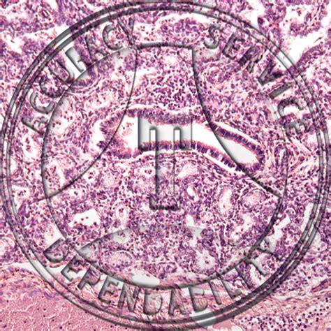 Fetal Human Lung Prepared Microscope Slide