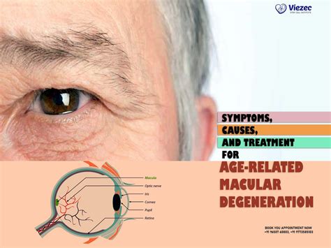 Symptoms And Treatment For Age Related Macular Degeneration