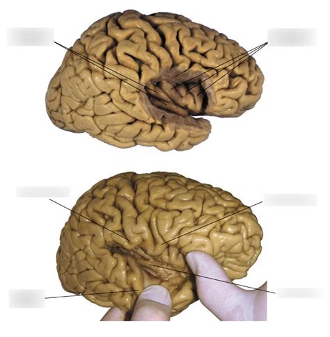 The Insular Lobe Diagram Quizlet