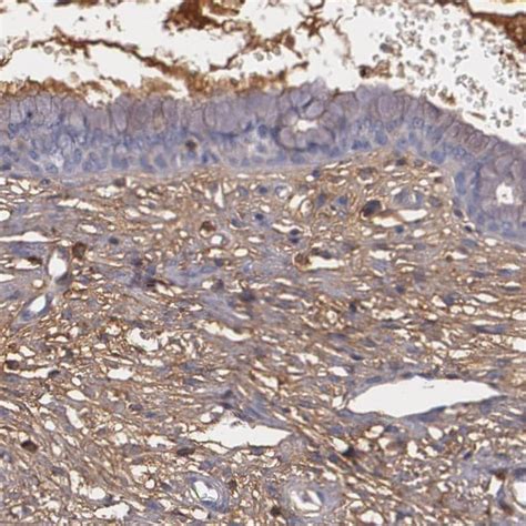 Fibulin 1 Antibody Pa5 51613