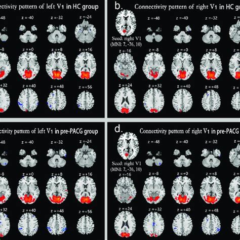 IFC Spatial Distribution Maps Of V1 IFC Spatial Distribution Maps Of Download Scientific