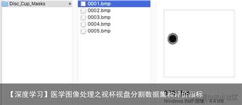 【深度学习】医学图像处理之视杯视盘分割数据集和评价指标 云恒制造