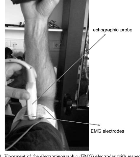 Figure 1 From Muscle Shear Elastic Modulus Measured Using Supersonic Shear Imaging Is Highly