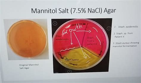 Solved Mannitol Salt 7 5 Nacl Agar 1 Staph Epidermitis