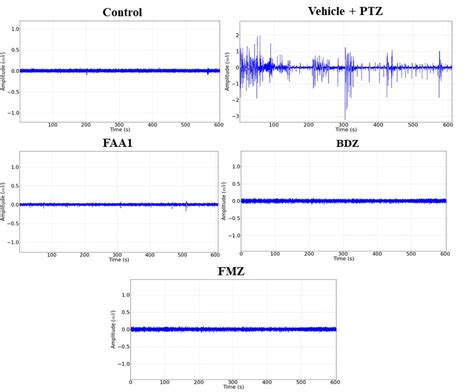 Representative Data Of Electrocorticographic Tracing For Control Download Scientific Diagram