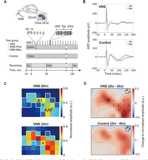 Figure 1 From Frequency Specific Modulation Of Oscillatory Activity In The Rat Auditory Cortex