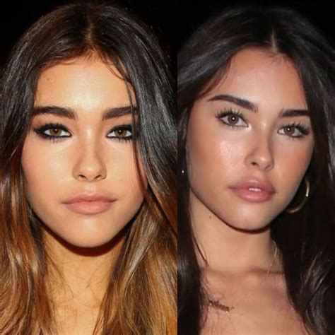 Madison Beer Plastic Surgery Fox Eye Filler Before And After Fox Eye