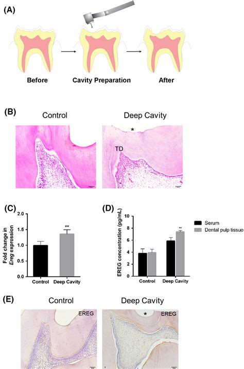 Epiregulin Ereg Is Activated During Tertiary Dentin Formation A Download Scientific Diagram
