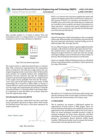 IRJET Brain Tumor Detection Using Convolutional Neural Network PDF Cancer Diseases And