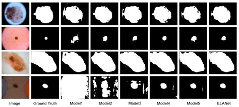 Ela Net An Efficient Lightweight Attention Network For Skin Lesion Segmentation
