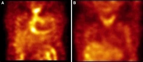 What Is This Image 2017 Image 2 Journal Of Nuclear Cardiology