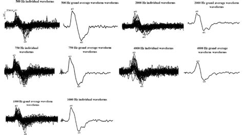 The Individual And Grand Averaged Waveforms Of Recorded Mvemp For All